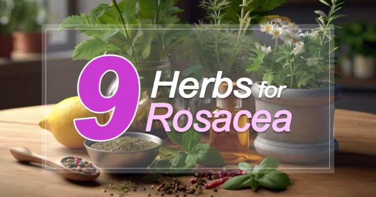 Herbs for Rosacea: 9 Natural Skin Remedies